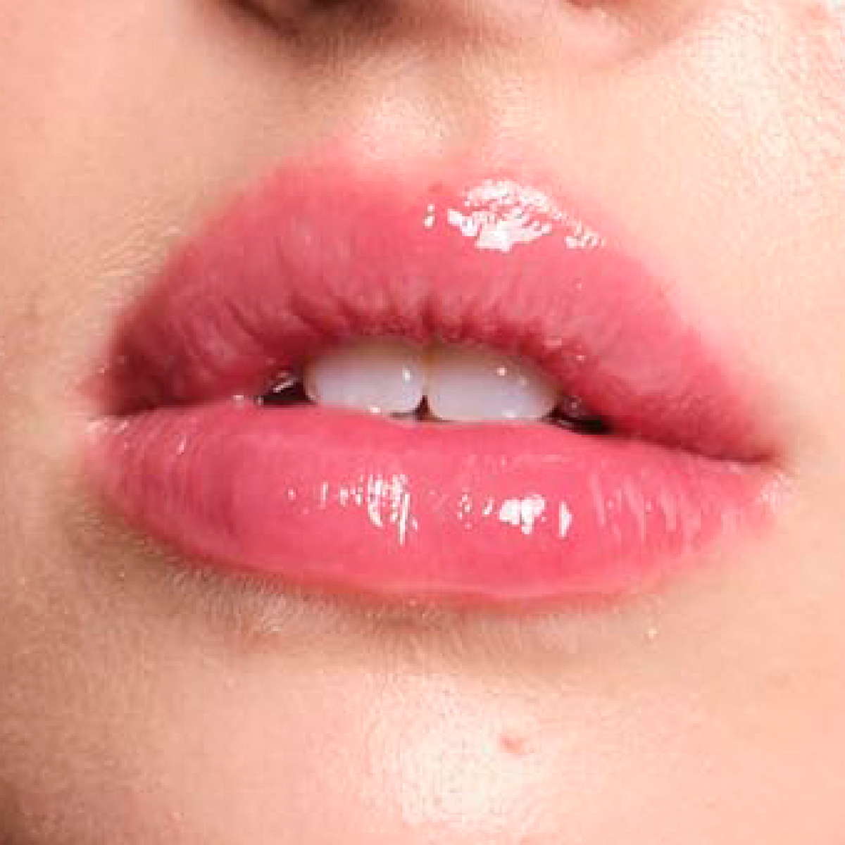 No Needles Lip Filler Kit: Original – Plump it!