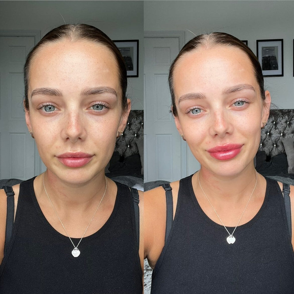 No Needles Lip Filler Kit: Original – Plump it!